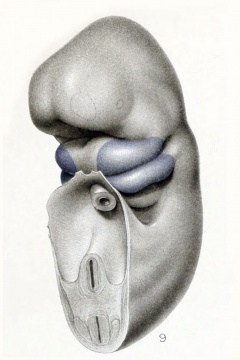 Hearing - Outer Ear Development - Embryology