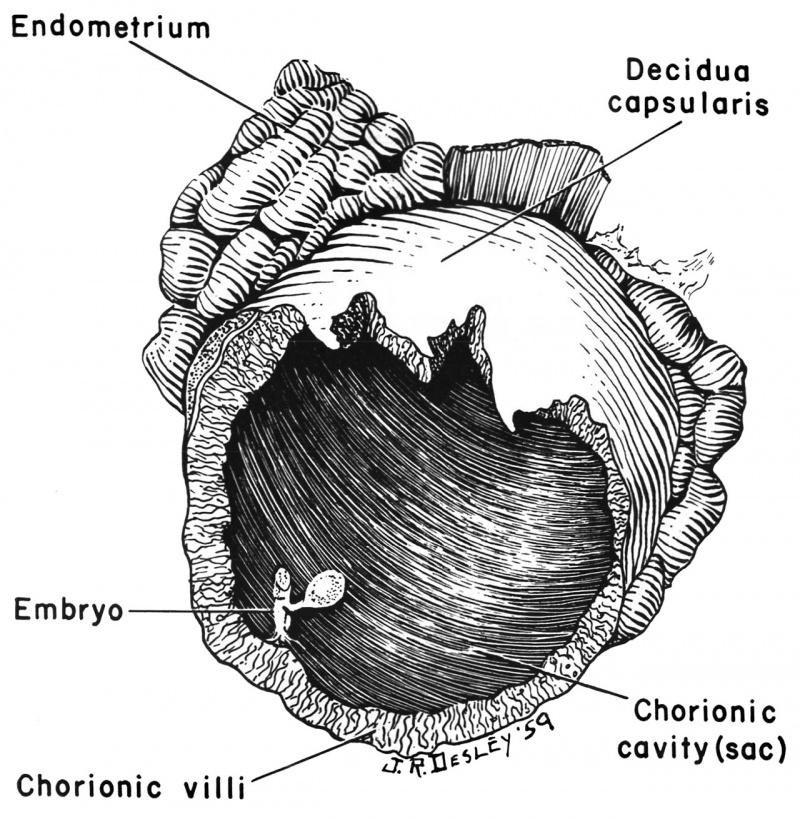 Paper - Two choice human embryos at Streeter's horizons XI and XIV ...