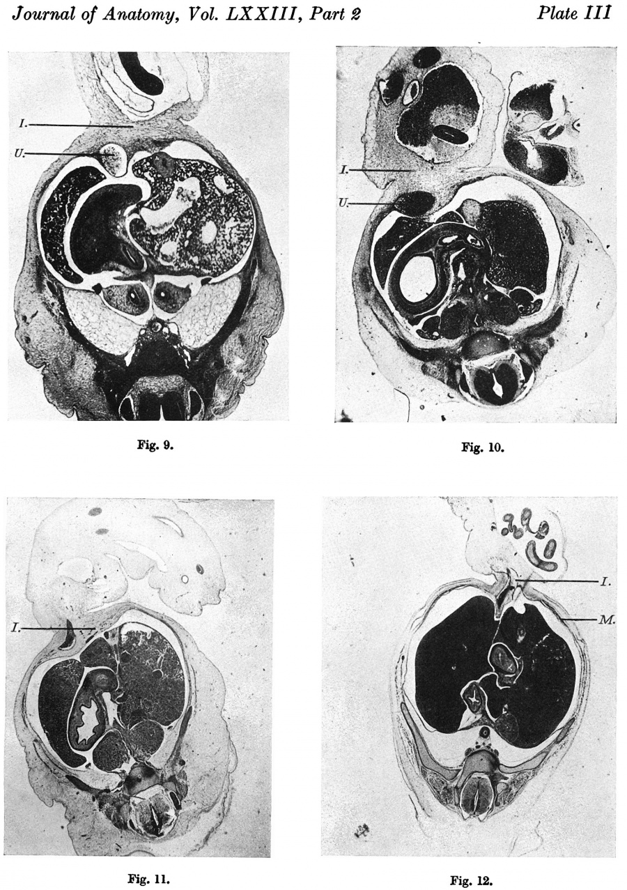 Paper - The formation of the umbilical cord and the umbilical region of ...
