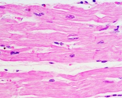 HM Practical - Cardiac Histology - Embryology