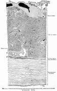 BGDA Practical Placenta - Maternal Decidua - Embryology