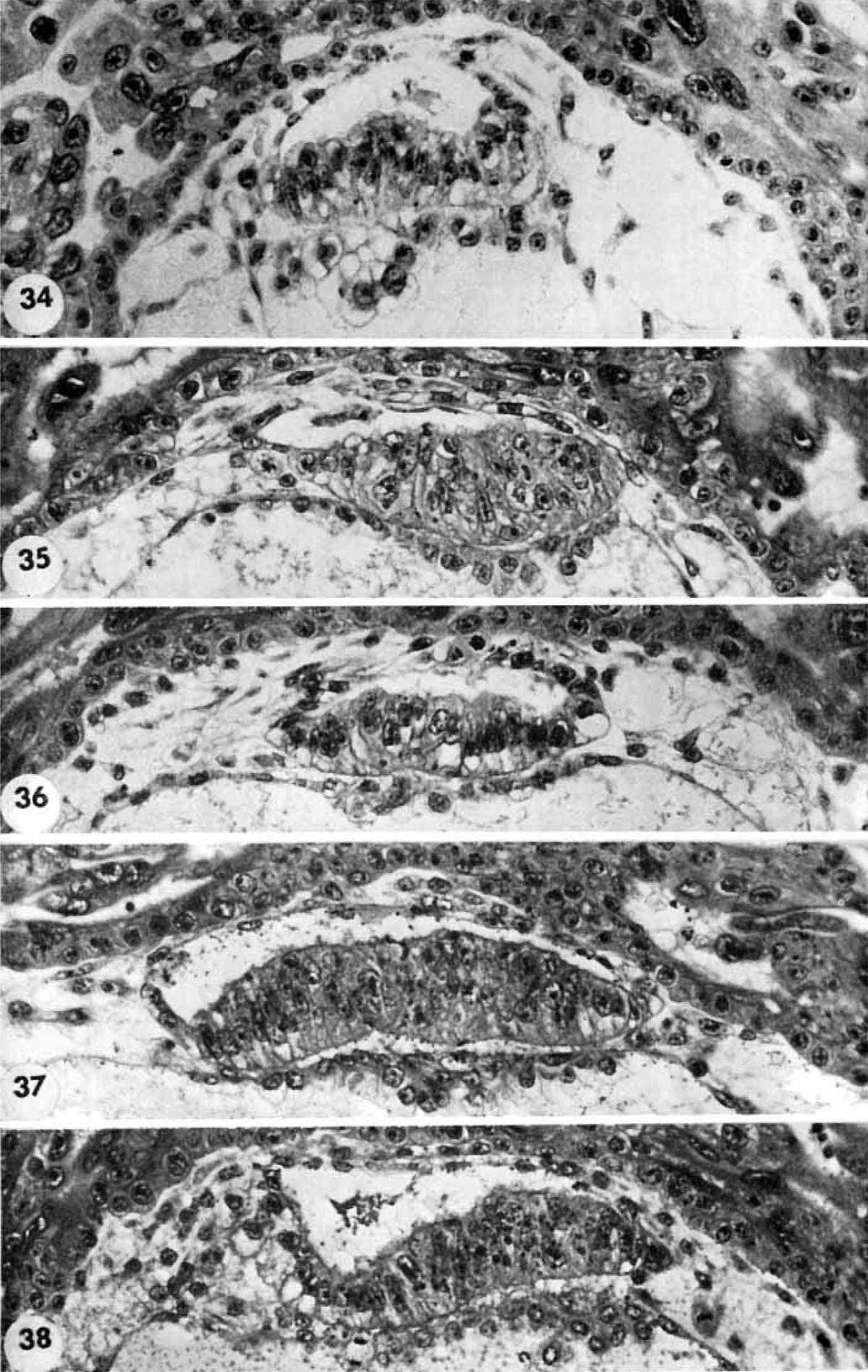 Paper - A description of 34 human ova within the first 17 days of ...