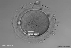 Human Fertilization Movie - Embryology