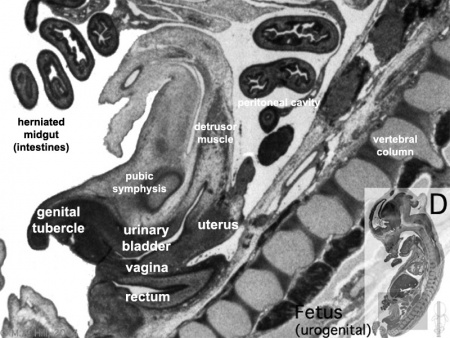 Genital - Female Development - Embryology