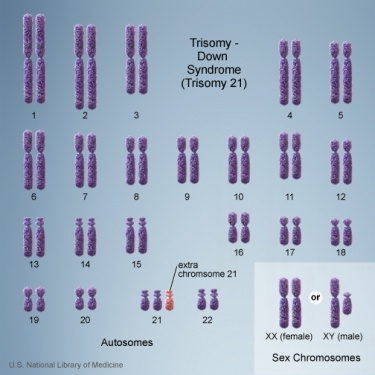 Trisomy 21 - Embryology