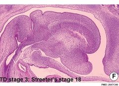 Tongue Development - Embryology