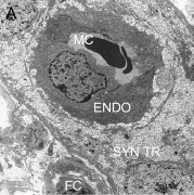 Category:Placenta - Embryology