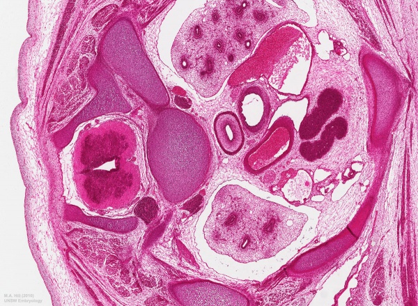 Thymus Development - Embryology