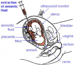 Prenatal Genetic Diagnosis - Embryology