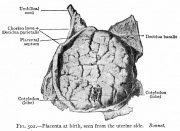 BGDA Practical Placenta - Maternal Decidua - Embryology