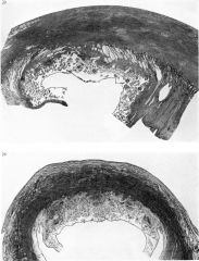 Paper - Development of the human placenta in the first three months of ...