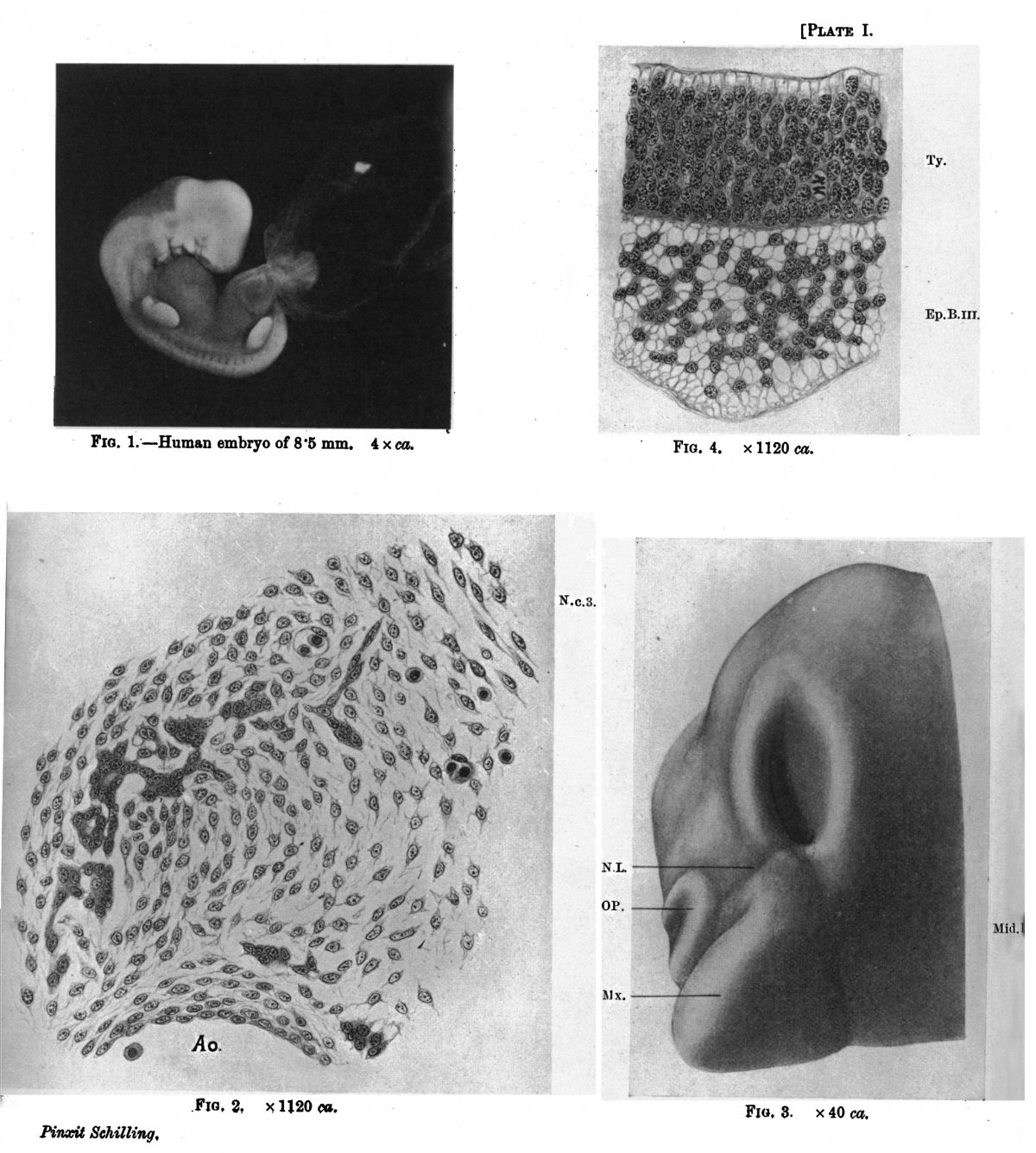 Paper - The Morphology and Histology of a Human Embryo of 8.5 mm ...