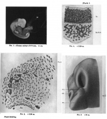 Category:Carnegie Stage 15 - Embryology