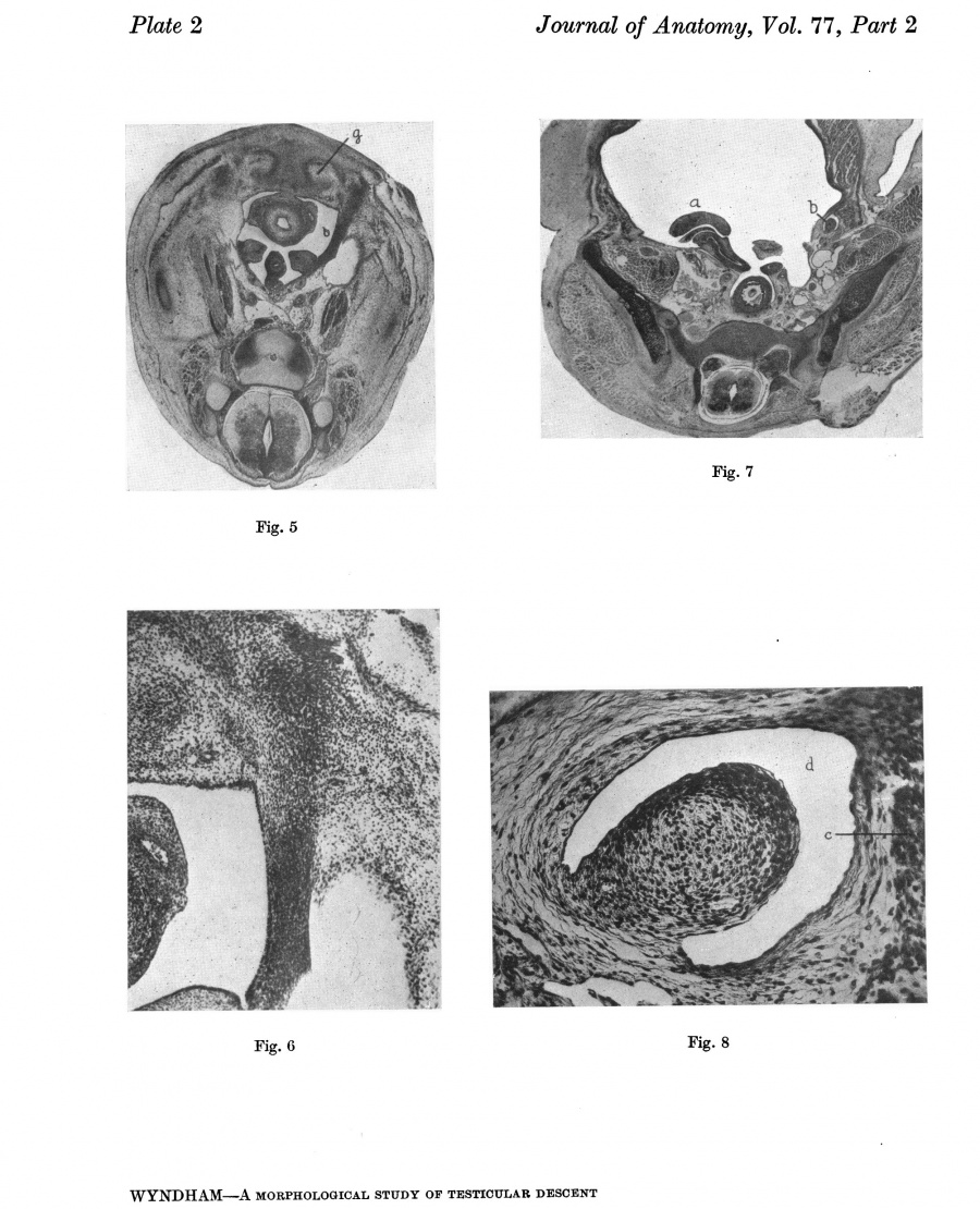Paper - A morphological study of testicular descent - Embryology