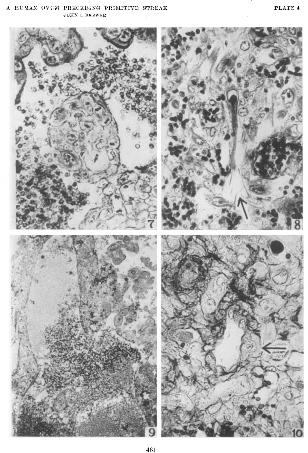 Paper - A normal human ovum in a stage preceding the primitive streak ...