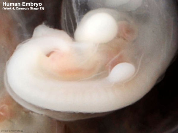 Carnegie stage 13 - Embryology