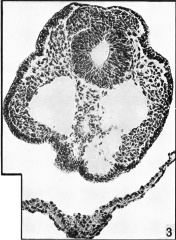 Category:Carnegie Stage 10 - Embryology
