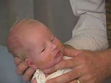 Neural Abnormal Exam - Newborn cranial nerve - Embryology