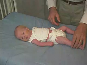 Neural Abnormal Exam - Newborn tone - popliteal angle - Embryology