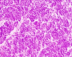 Thymus Development - Embryology