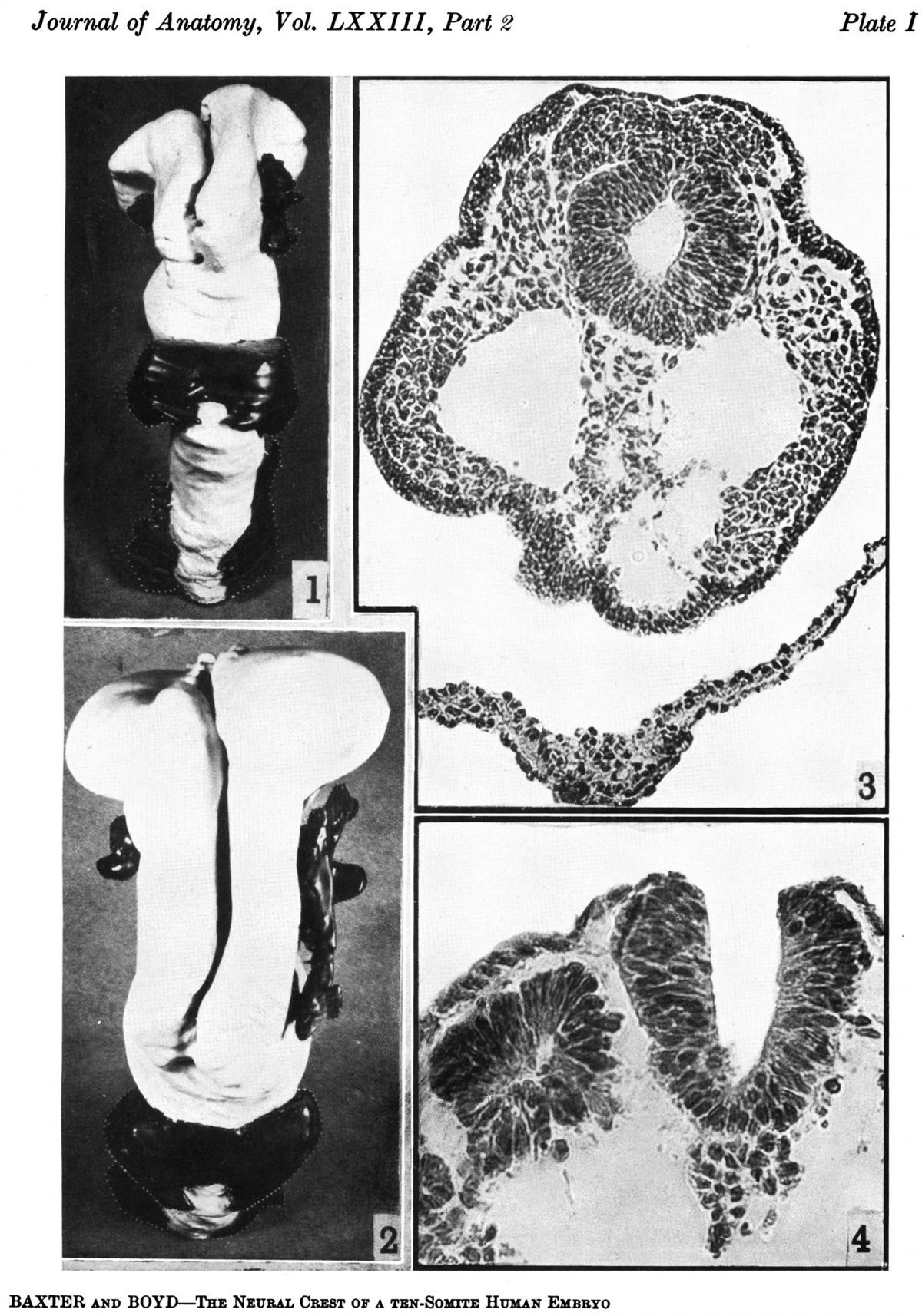 Paper - Observations on the neural crest of a ten-somite human embryo ...