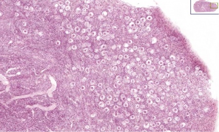 Endocrine - Gonad Development - Embryology