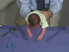 Neural Exam - Newborn positions - vertical suspension - Embryology
