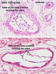 HM Practical - Blood Vessel Histology - Embryology