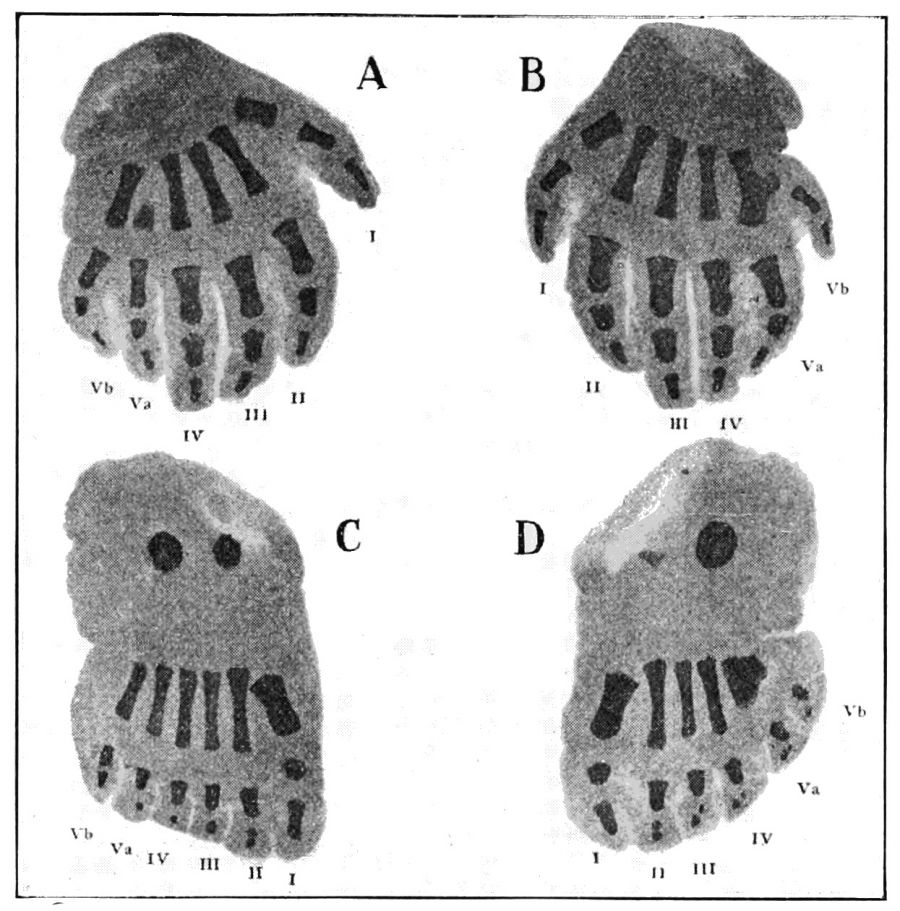 Paper - Extra digits and digital reductions - Embryology