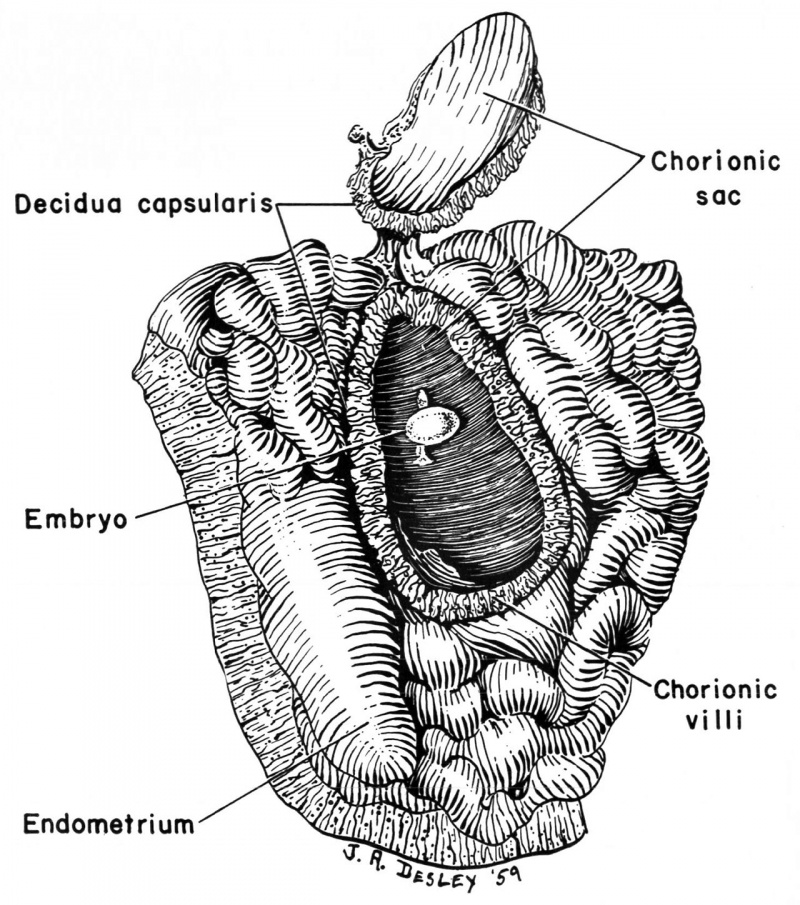 Paper - Two choice human embryos at Streeter’s horizons 11 and 14 ...