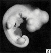 Hamburger Hamilton Stages - Embryology