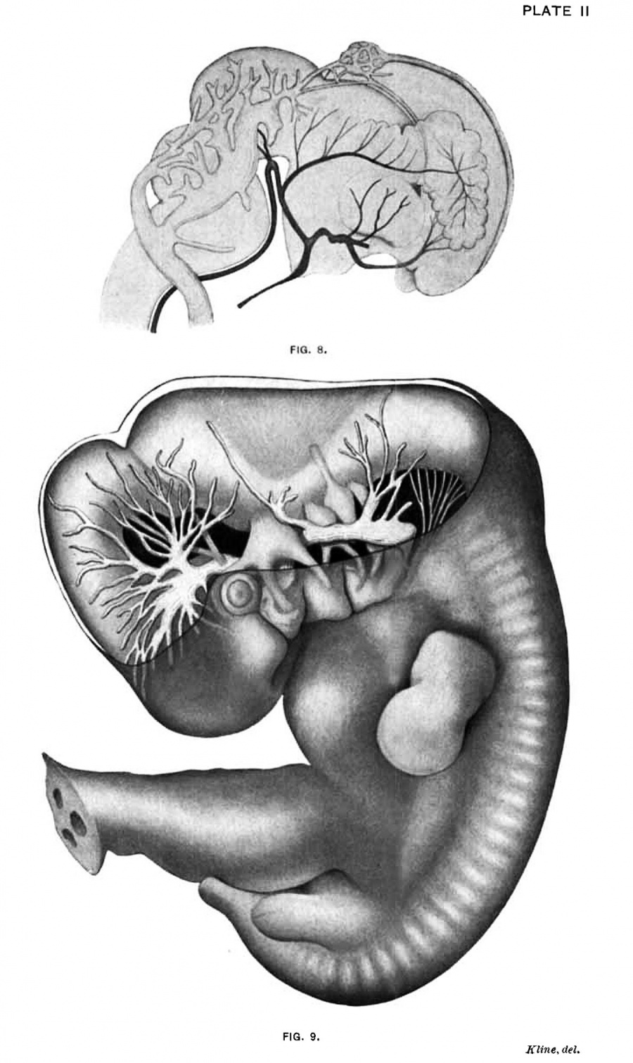 Paper - On the development of the blood-vessels of the brain in the ...