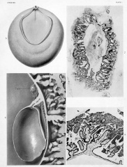 Embryology History - George Streeter - Embryology