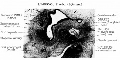 Hearing - Middle Ear Development - Embryology