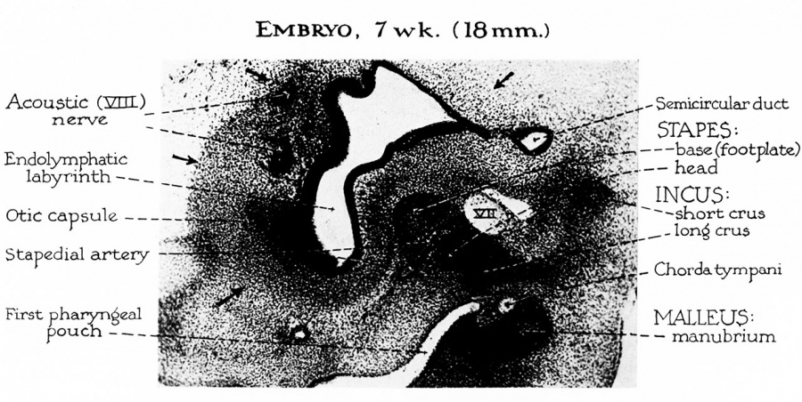 Paper - Development of the malleus of the human ear - Illustrated in ...