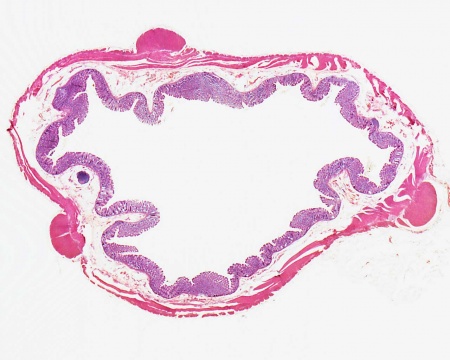 Gastrointestinal Tract - Colon Histology - Embryology