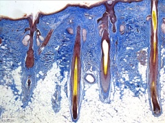 Integumentary System - Hair Development - Embryology