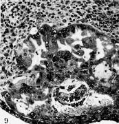 Paper - On the development of the amnion and exocoelomic membrane in ...