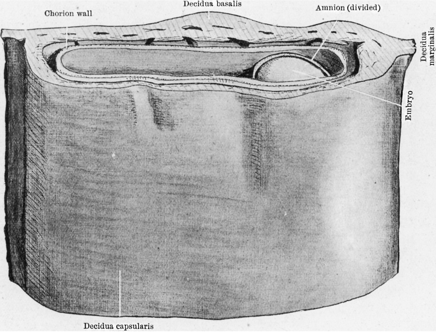Paper - A very Young Human Embryo found embedded in a "Decidual Cast ...