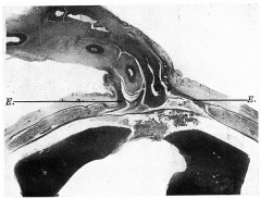 Paper - The formation of the umbilical cord and the umbilical region of ...