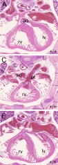 Category:Mouse E17.5 - Embryology