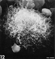 Immune System Development - Embryology
