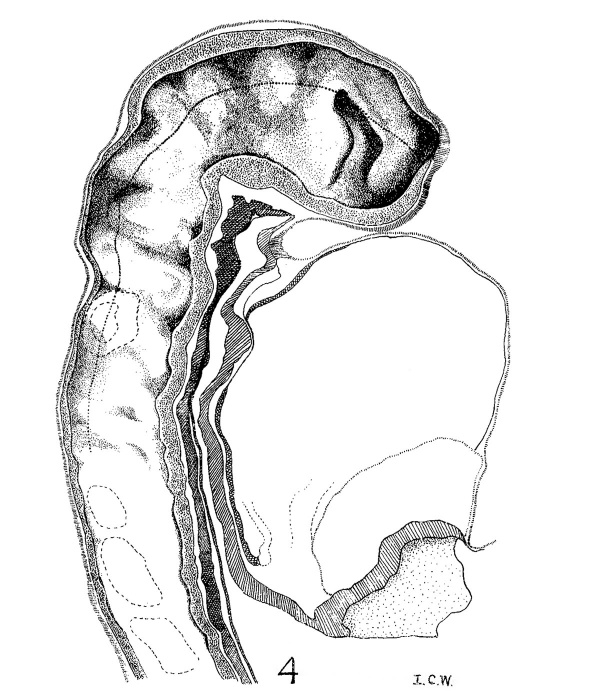 Paper - The Anatomy of Human Embryos with Seventeen to Twenty-three ...
