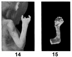 Embryology History - Franklin Mall - Embryology