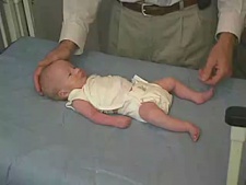 Neural Abnormal Exam - Newborn tone - heel to ear - Embryology