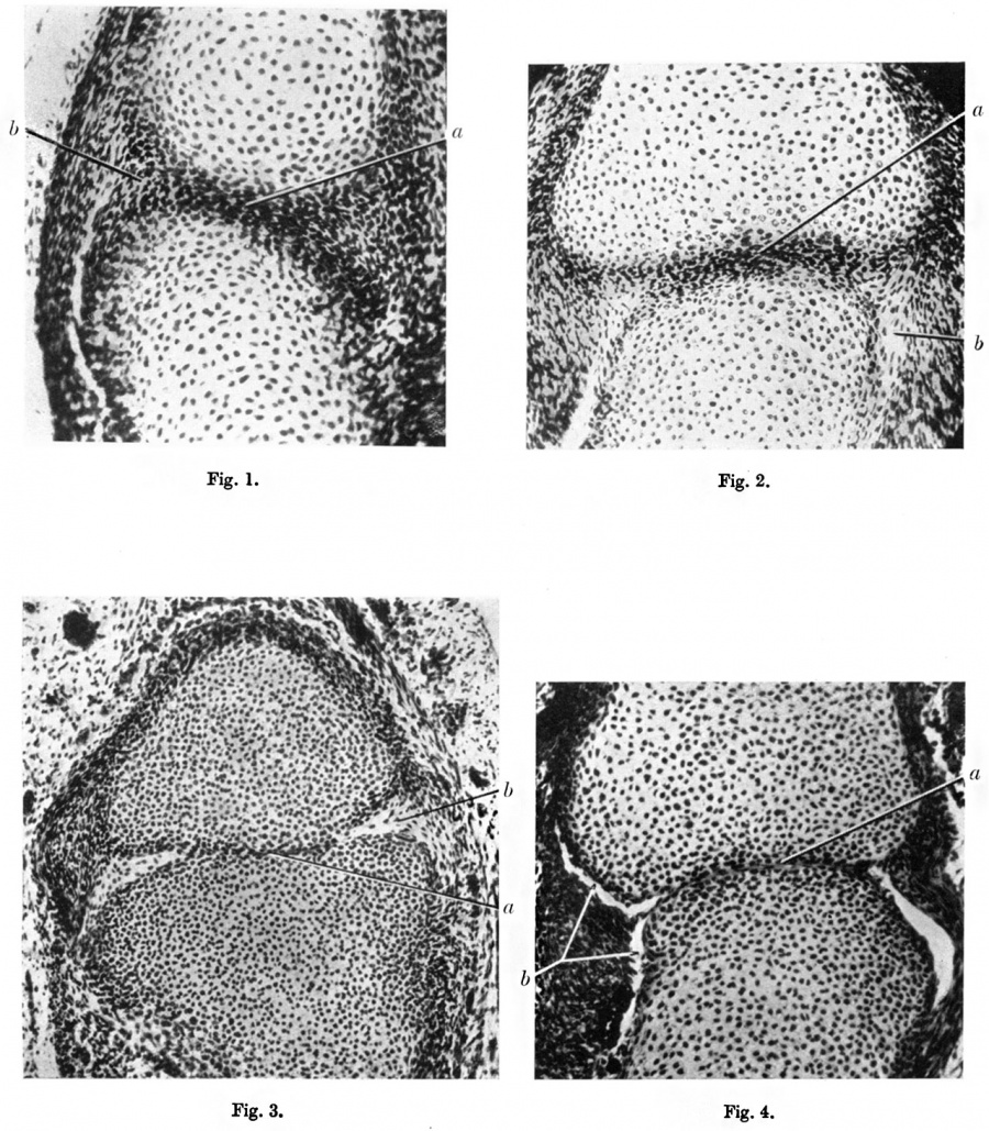 Paper - The development of synovial joints - Embryology