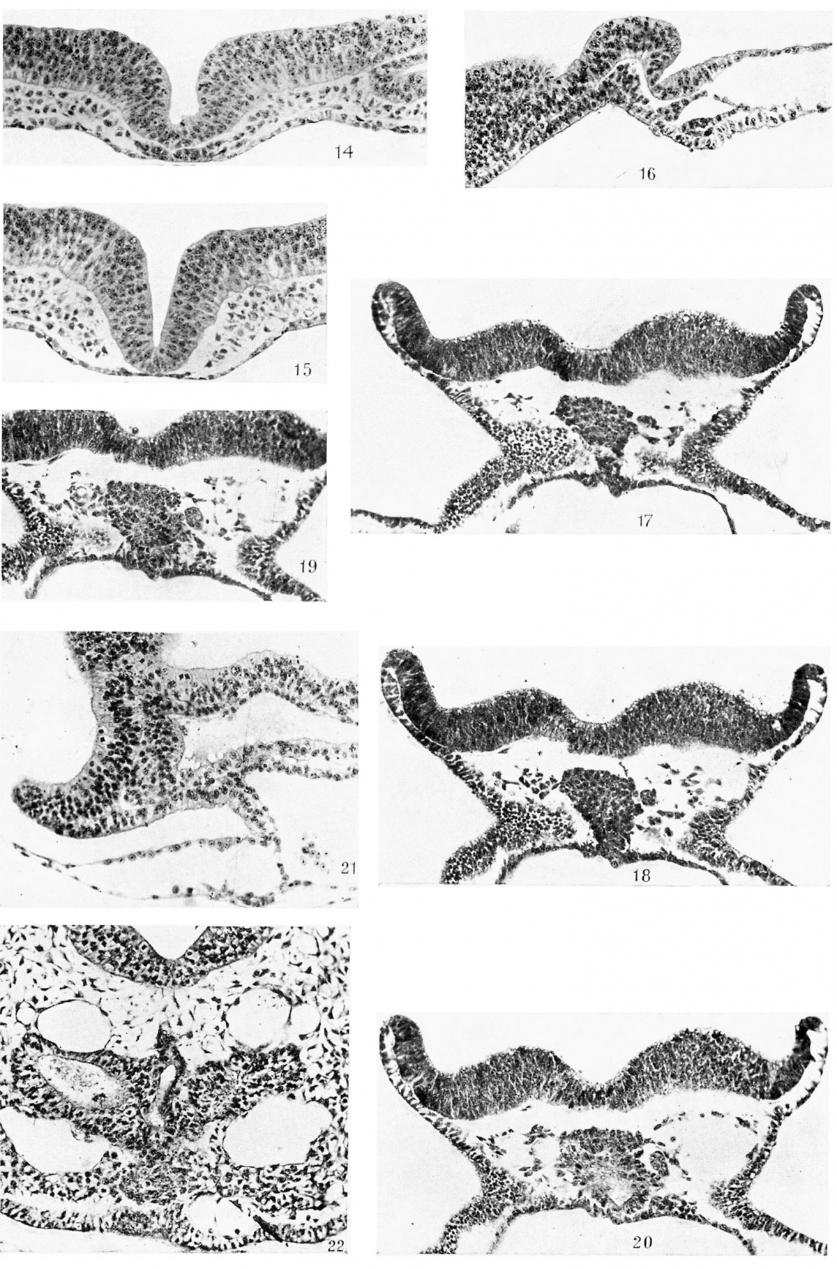 Paper - The history of the prochordal plate in the rabbit - Embryology
