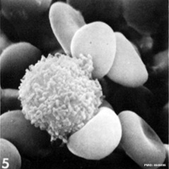 Thymus Development - Embryology