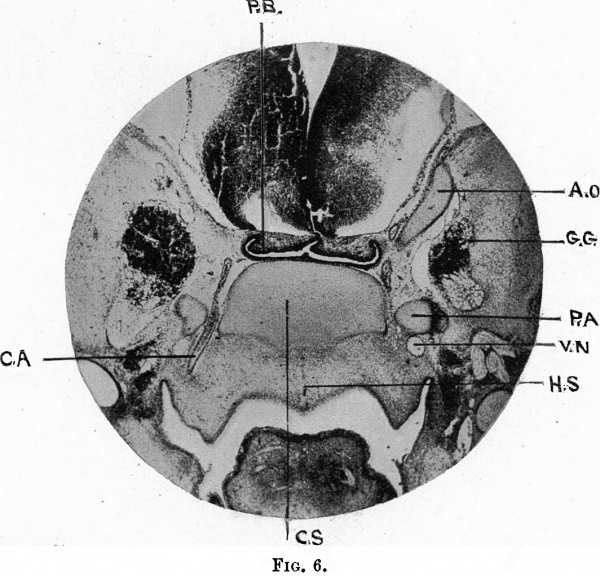 Paper - Notes on the development of the human sphenoid (1910) - Embryology