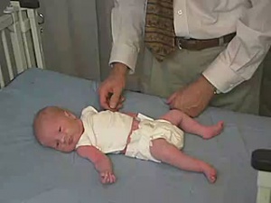 Neural Abnormal Exam - Newborn positions - ventral suspension - Embryology